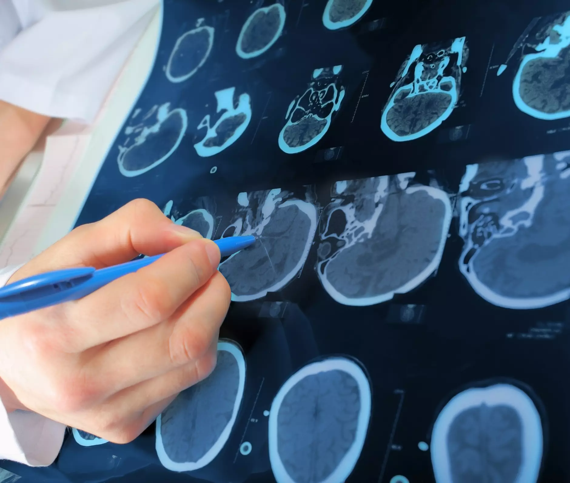 Pregledi možganov kažejo, da lahko izboljšate svoje možgane.